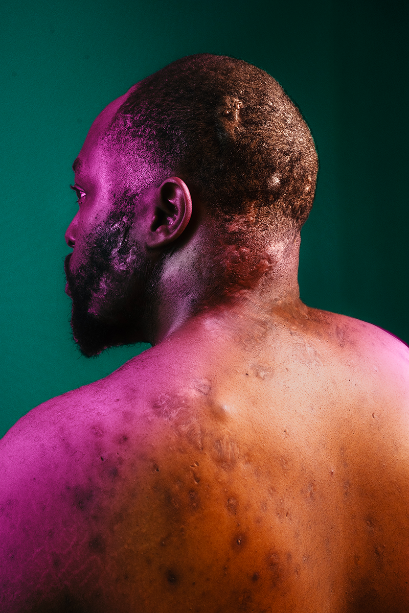 What is HS - HS Connect